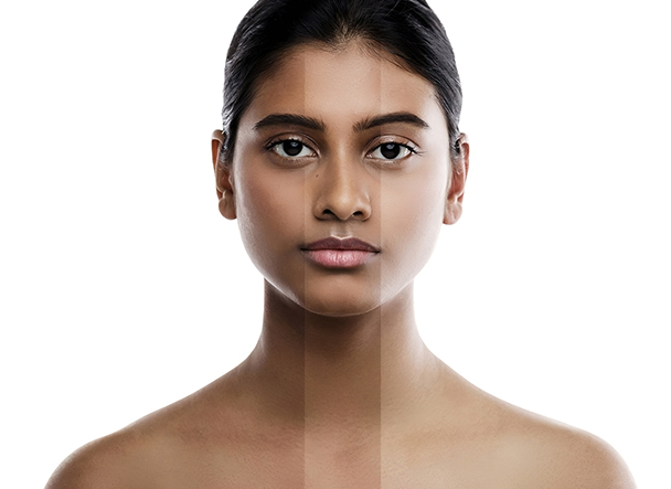 Uneven Skin Tone Treatment | Experts Skin & Hair Clinic